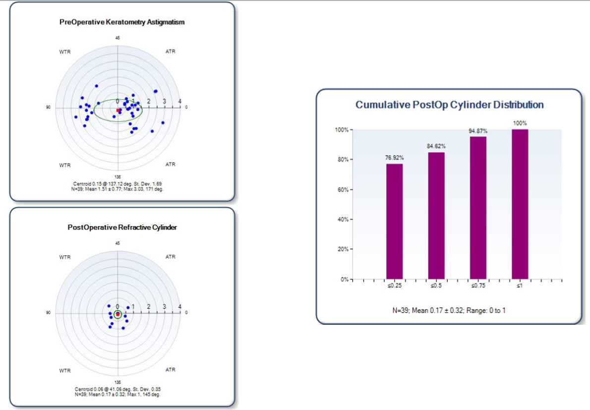 V-Lynk（術中イメージガイダンスシステム：ORA SYSTEM™ with VerifEye™ Lynk）の実力 – うえだ眼科クリニック ブログ